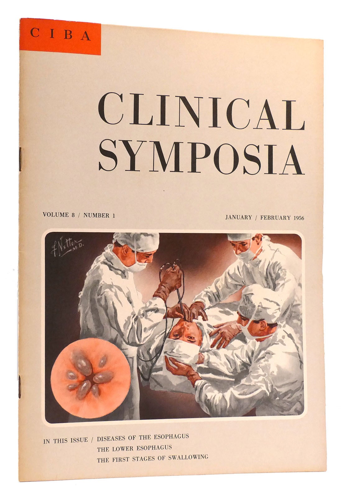 CLINICAL SYMPOSIA Volume 8, Number 1, 1956: Diseases of the Esophagus ...